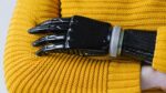 What Is a Hand Prosthetic? Types, Uses, and Benefits for Amputees ...